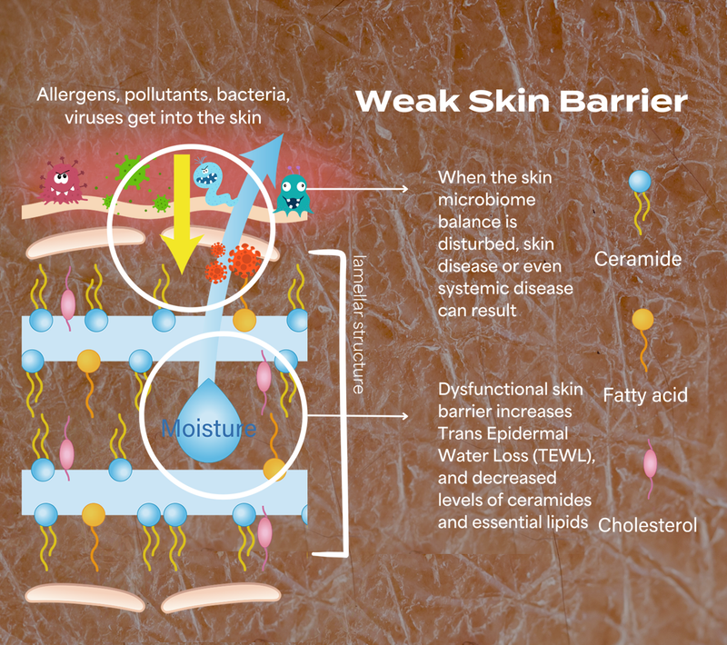 Repair Your Skin Barrier Naturally to Improve Eczema Conditions – CelRevive